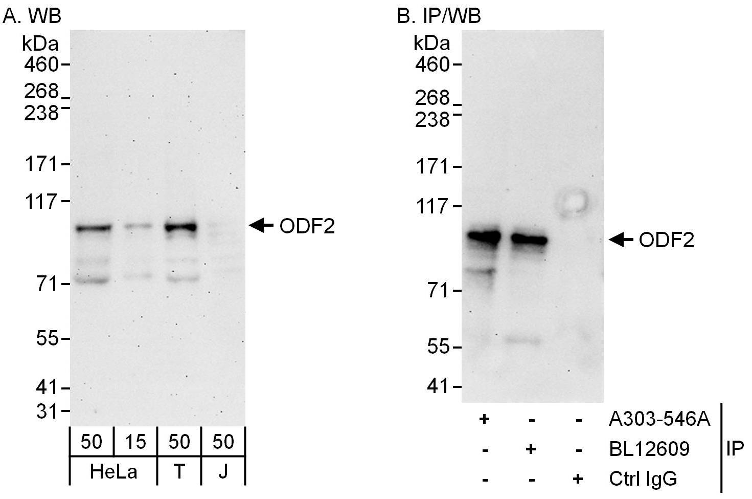 Rabbit anti-ODF2 Antibody - Fortis Life Sciences