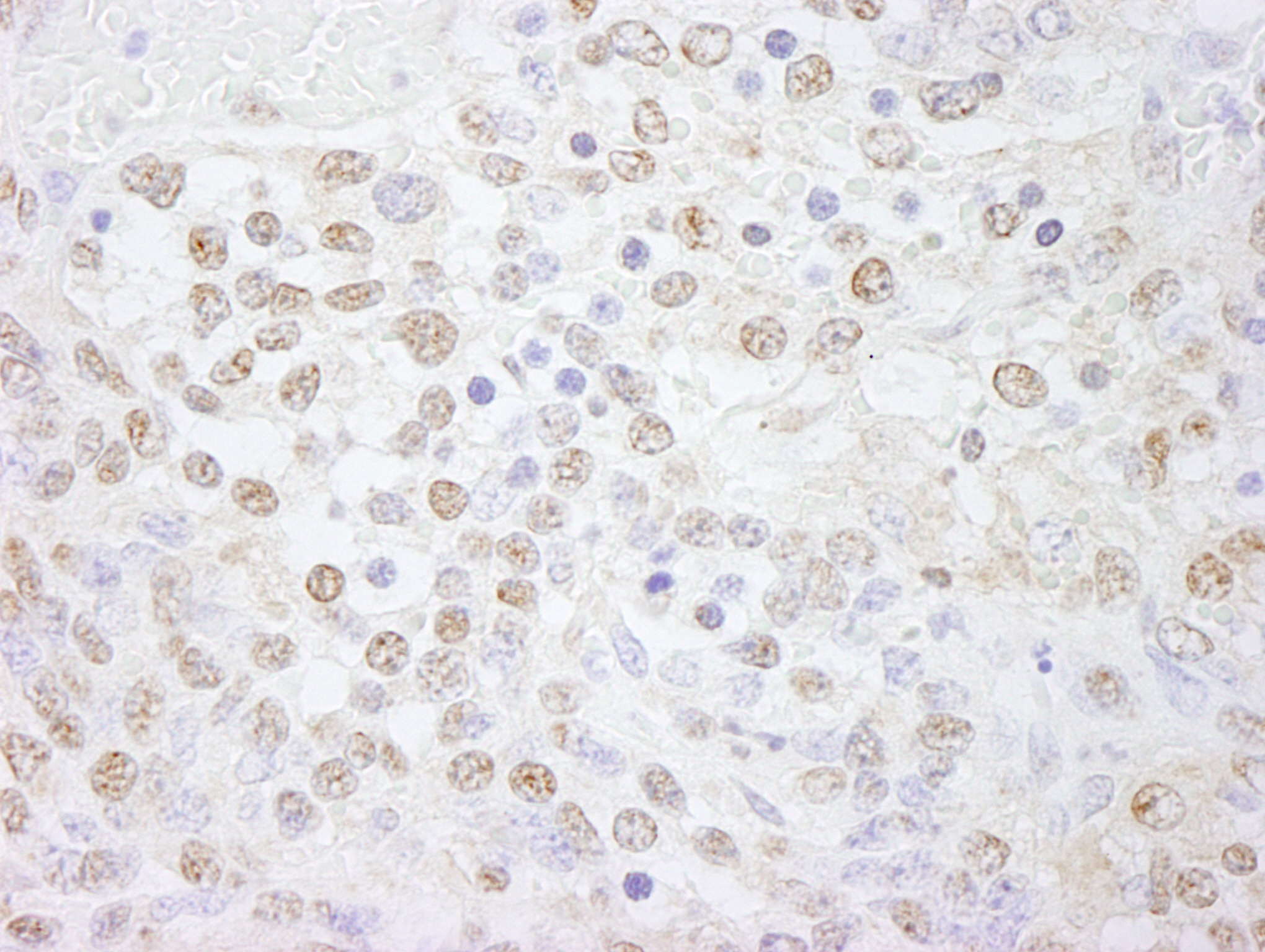 Rabbit anti-Pol Lambda IHC Antibody - Fortis Life Sciences