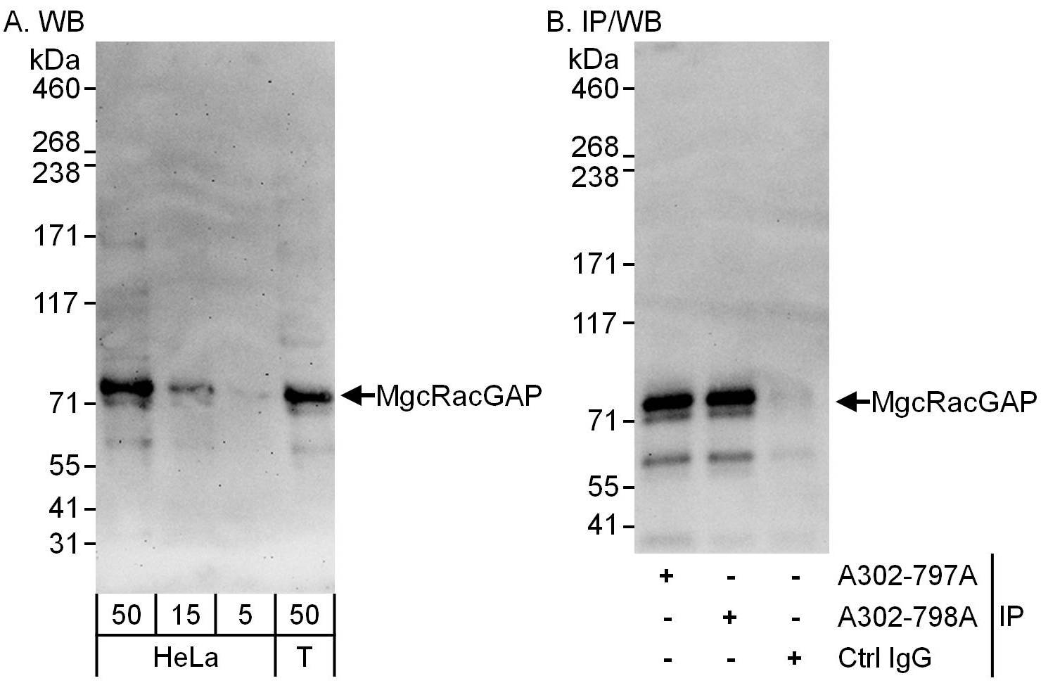 Rabbit anti-MgcRacGAP Antibody (Bethyl A302-797) - Fortis Life Sciences