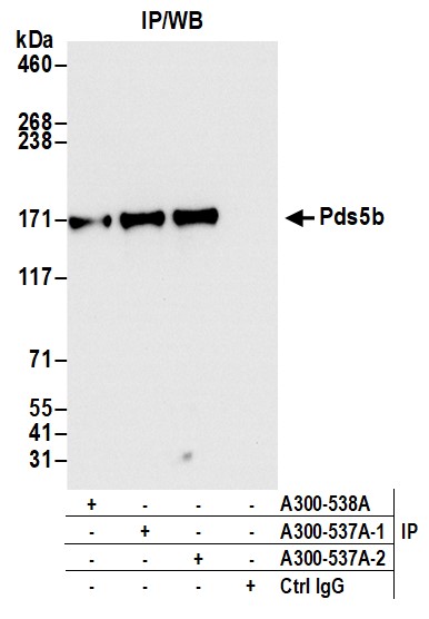 Rabbit anti-Pds5B Antibody (Bethyl A300-537) - Fortis Life Sciences