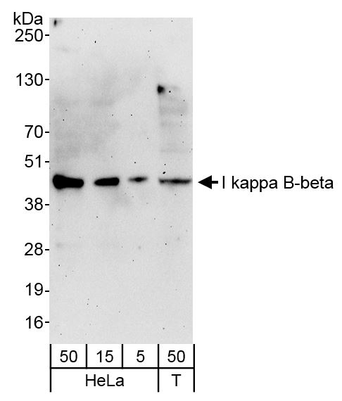 Rabbit anti-I kappa B-beta Antibody - Fortis Life Sciences