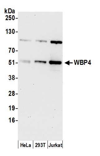 Rabbit anti-WBP4 Antibody - Fortis Life Sciences