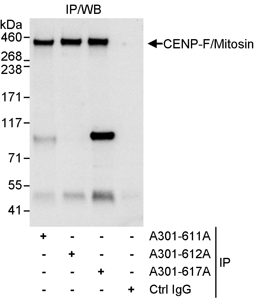 Rabbit anti-CENP-F/Mitosin Antibody (Bethyl A301-612) - Fortis Life ...