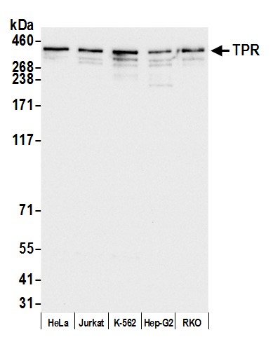 Rabbit anti-TPR Antibody (Bethyl A300-826) - Fortis Life Sciences