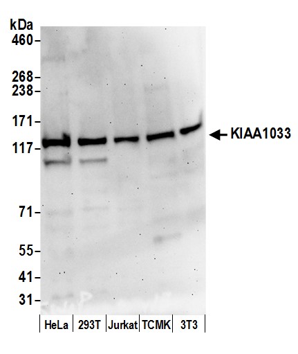 Rabbit anti-KIAA1033/WASH complex subunit 7 Antibody (Bethyl A304-919 ...