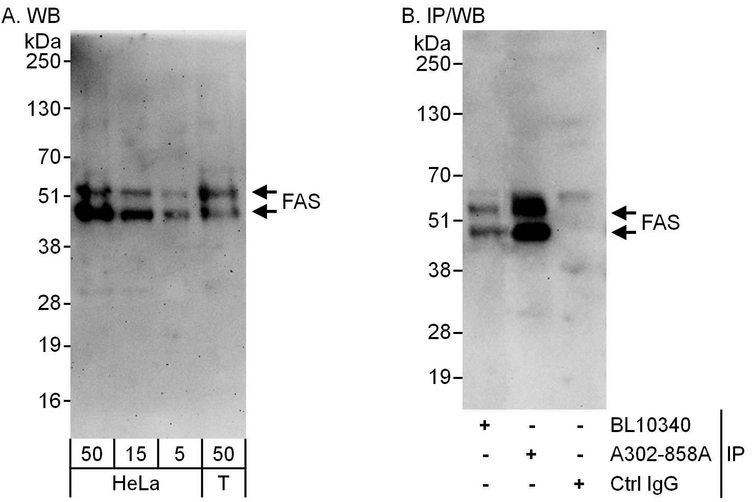 Rabbit anti-FAS Antibody - Fortis Life Sciences