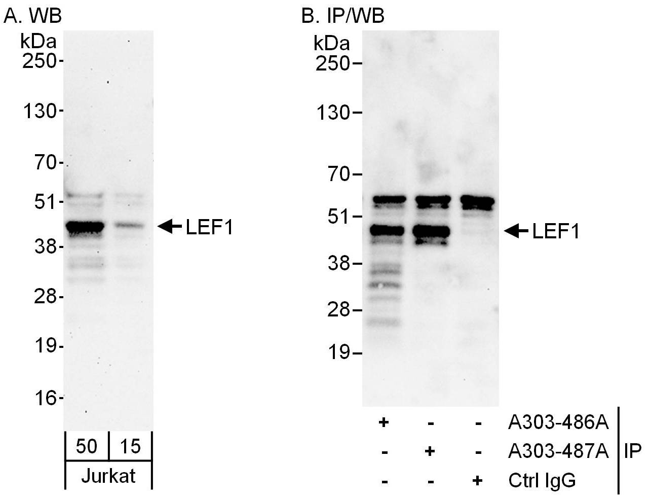 Rabbit anti-LEF1 Antibody (Bethyl A303-487) - Fortis Life Sciences