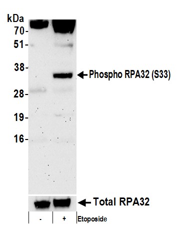 Rabbit anti-Phospho RPA32 (S33) Antibody - Fortis Life Sciences