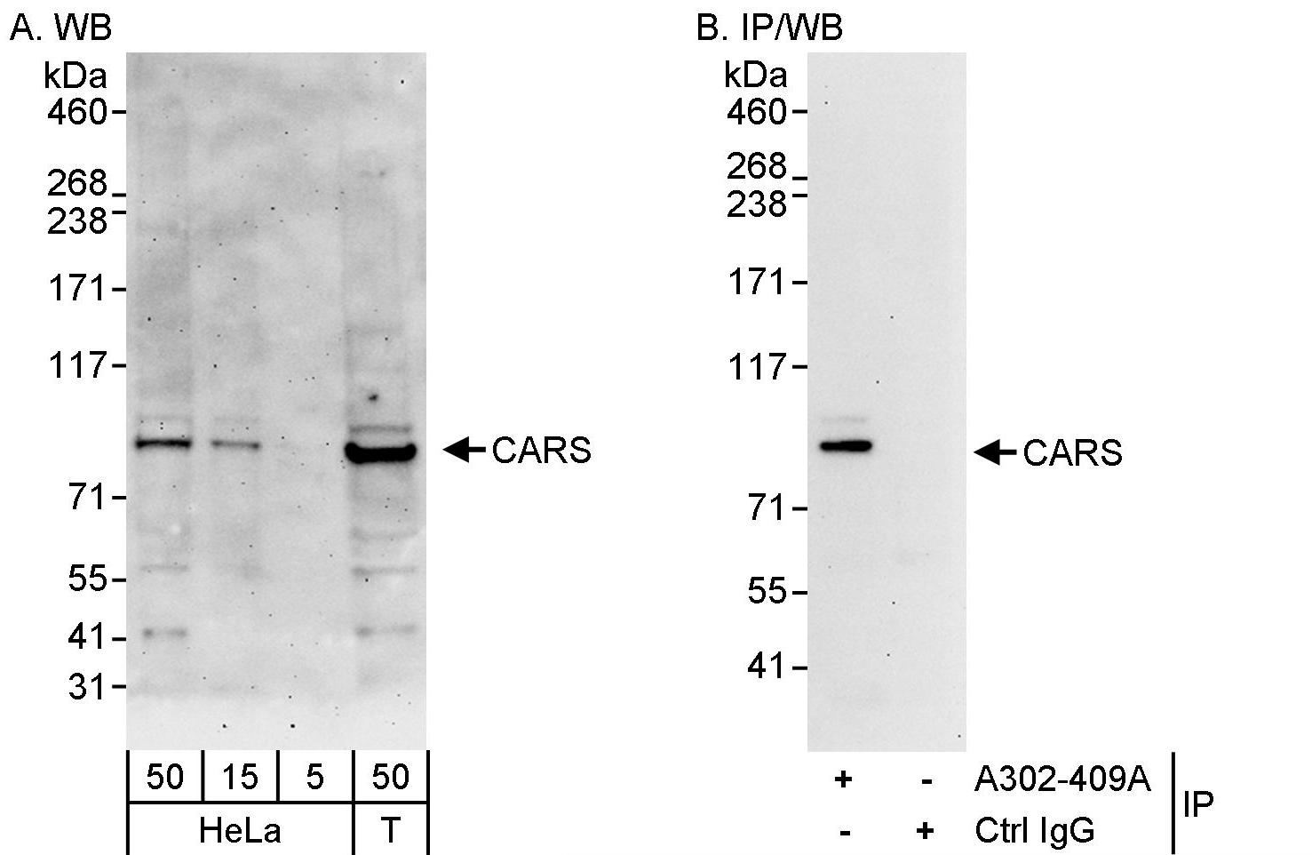 Rabbit anti-CARS Antibody - Fortis Life Sciences