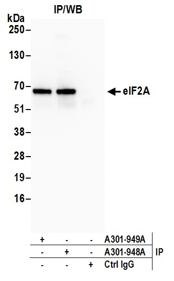 Rabbit anti-eIF2A Antibody (Bethyl A301-948) - Fortis Life Sciences