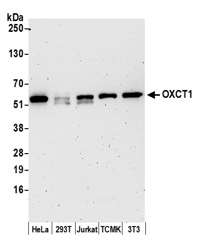 Rabbit anti-OXCT1 Antibody (Bethyl A305-540) - Fortis Life Sciences