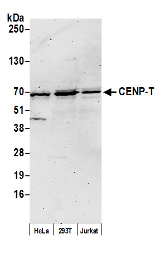 Rabbit anti-CENP-T Antibody (Bethyl A302-313) - Fortis Life Sciences