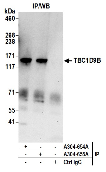 Rabbit anti-TBC1D9B Antibody (Bethyl A304-654) - Fortis Life Sciences