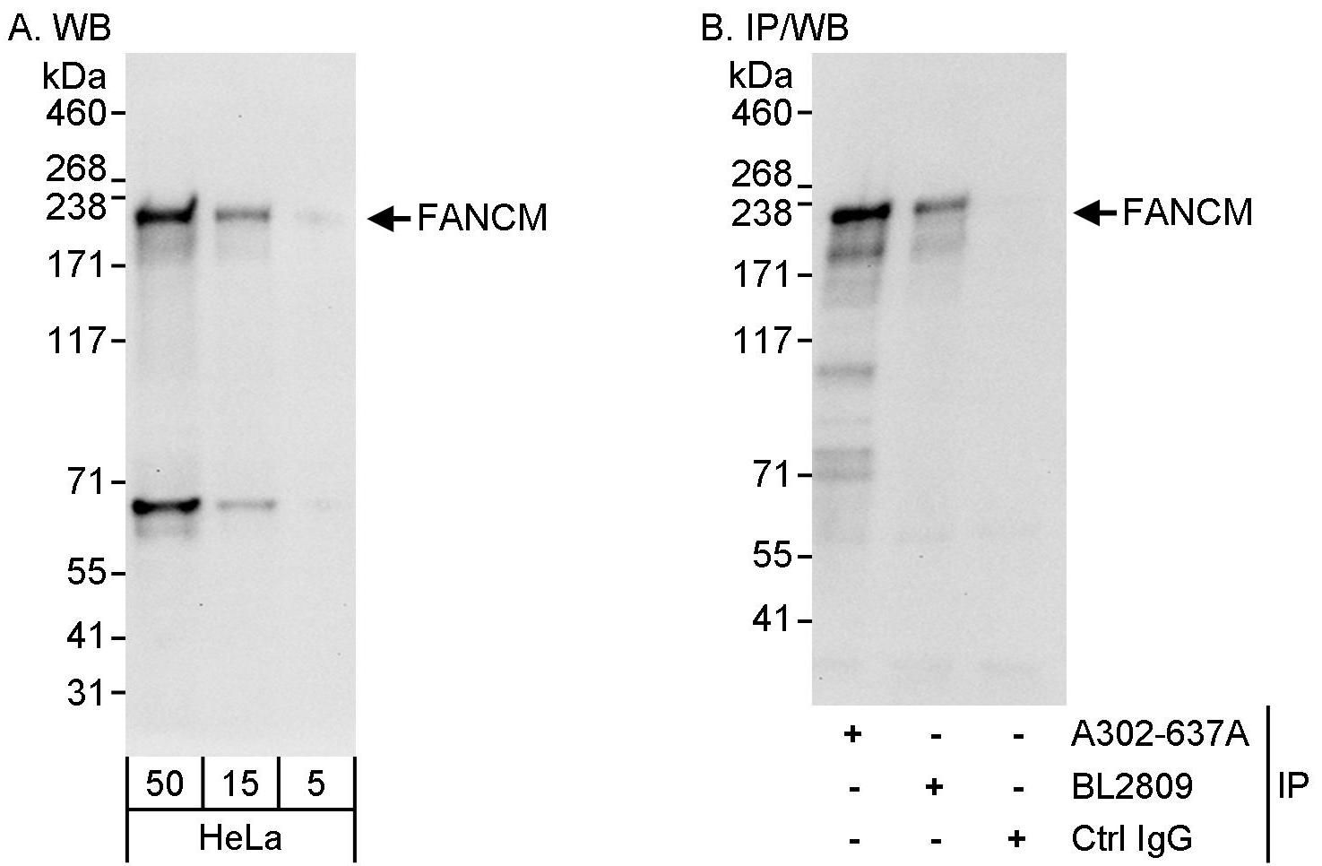 Rabbit anti-FANCM Antibody - Fortis Life Sciences