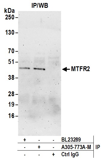 Rabbit anti-MTFR2 Antibody - Fortis Life Sciences