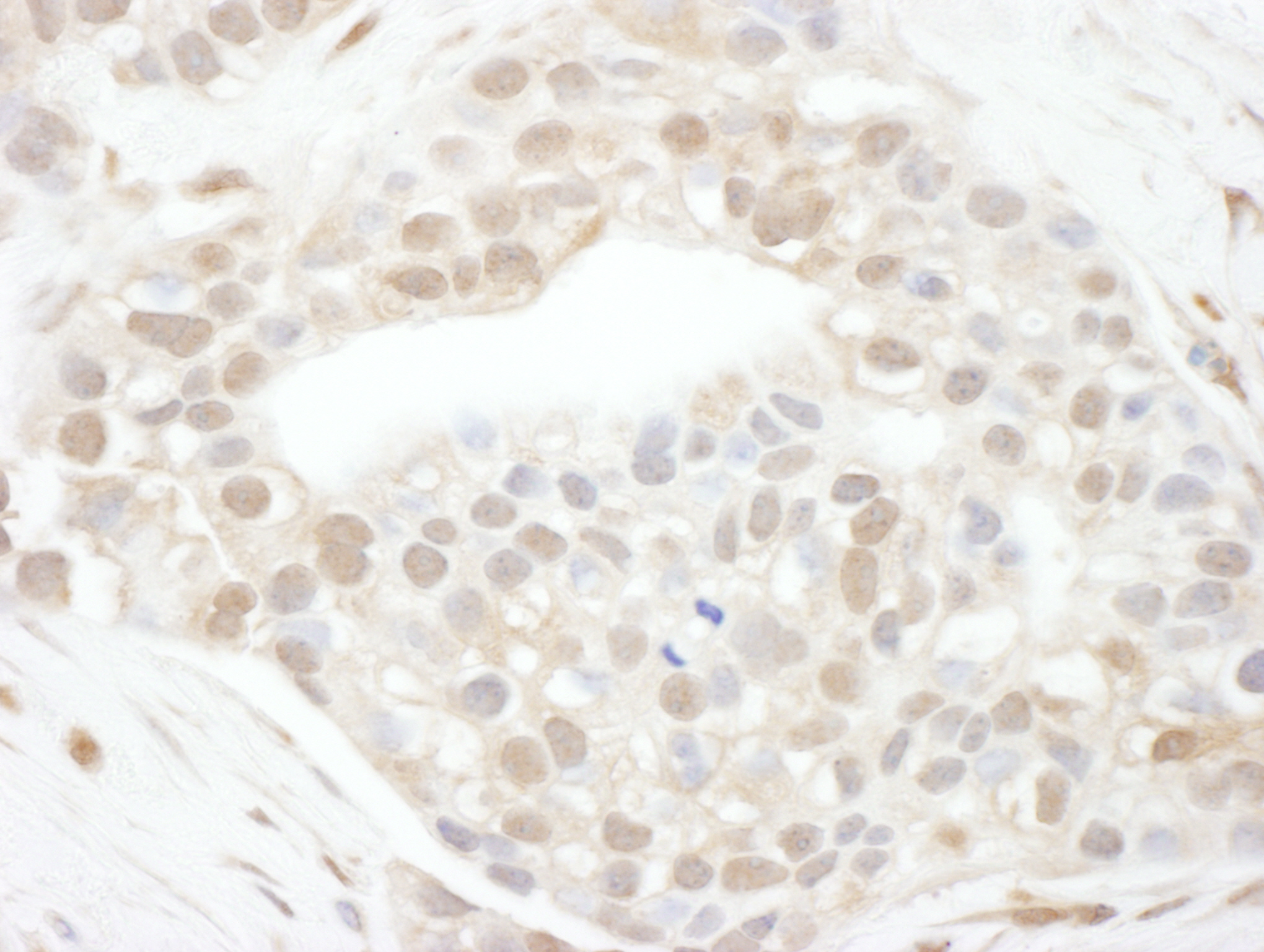 Rabbit anti-Cyclin T1 Antibody (Bethyl A303-496) - Fortis Life Sciences