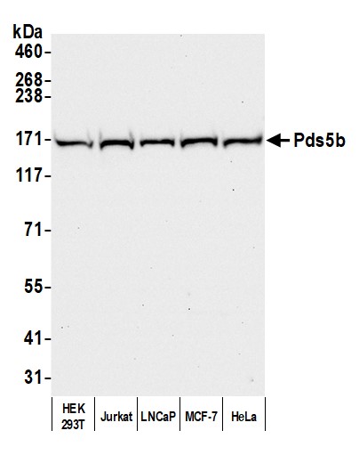 Rabbit anti-Pds5B Antibody (Bethyl A300-538) - Fortis Life Sciences