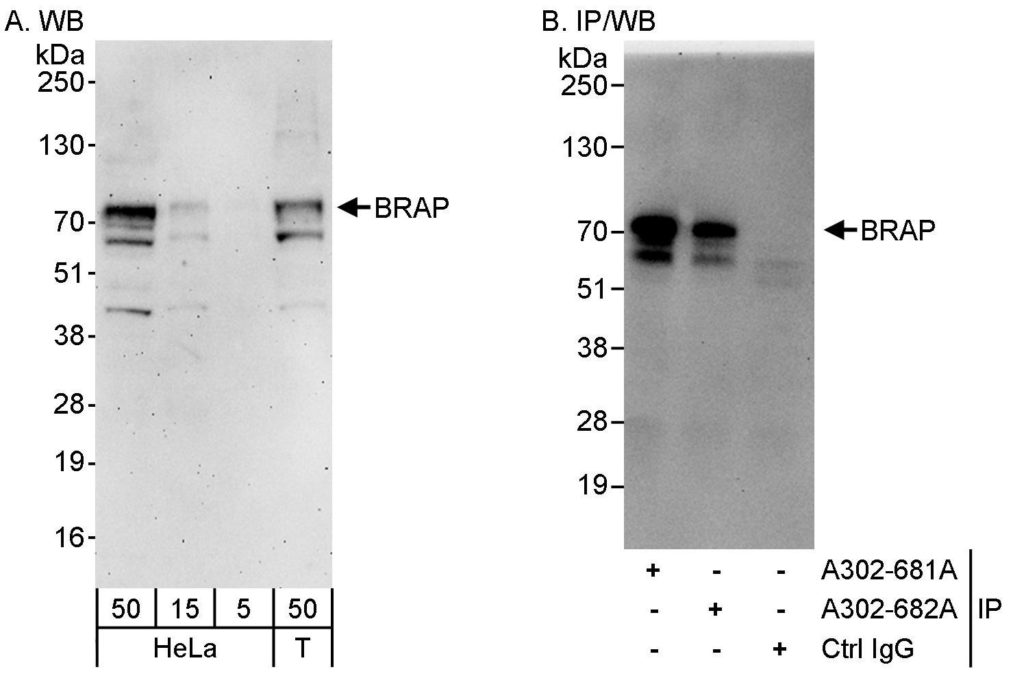 Rabbit anti-BRAP Antibody (Bethyl A302-682) - Fortis Life Sciences