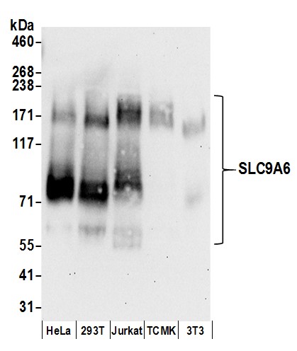 Rabbit anti-SLC9A6 Antibody (Bethyl A304-448) - Fortis Life Sciences